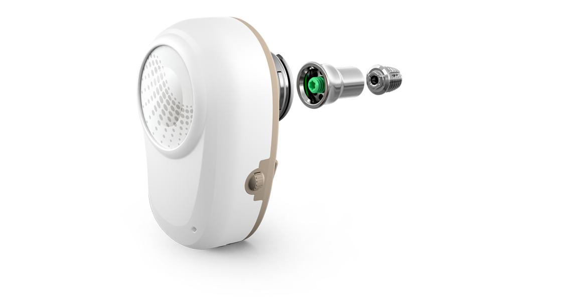 Order a Ponto processor upgrade